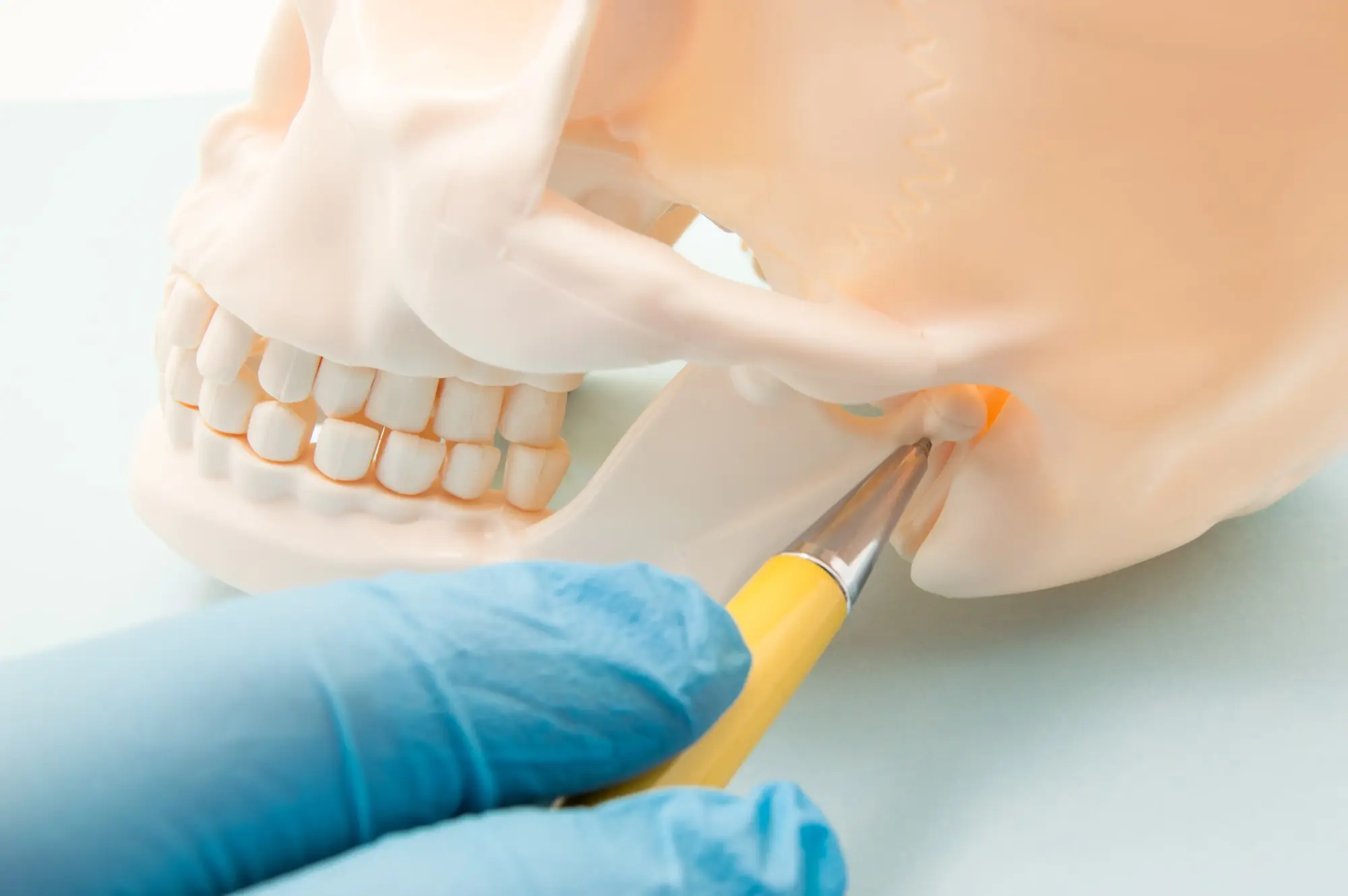 Sindrome dell'articolazione temporo-mandibolare | OrthoDental